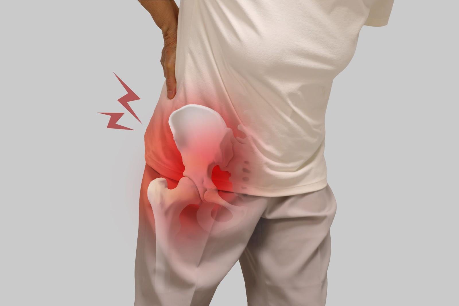 Hip Labral Tear | Cove Orthopaedic Clinic